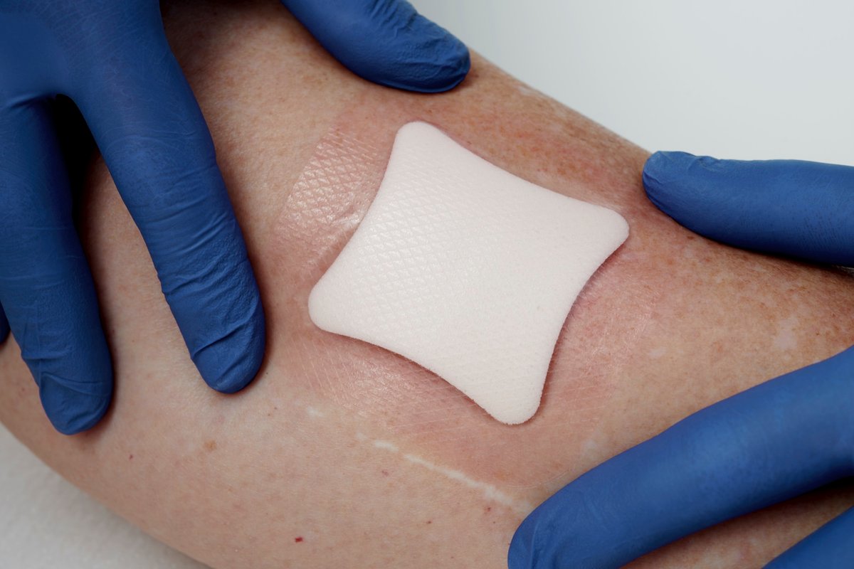 Leitfaden: Wundauflagen gezielt einsetzen